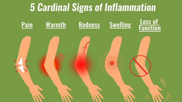 Understanding Cardinal Signs of Inflammation – Elevate Now